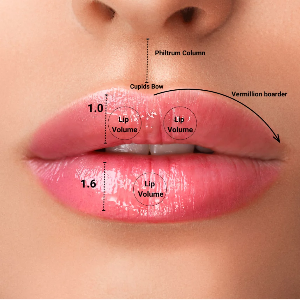 Lip Filler, avoiding duck lips | Elite Medical & Aesthetics | Lone Tree ...