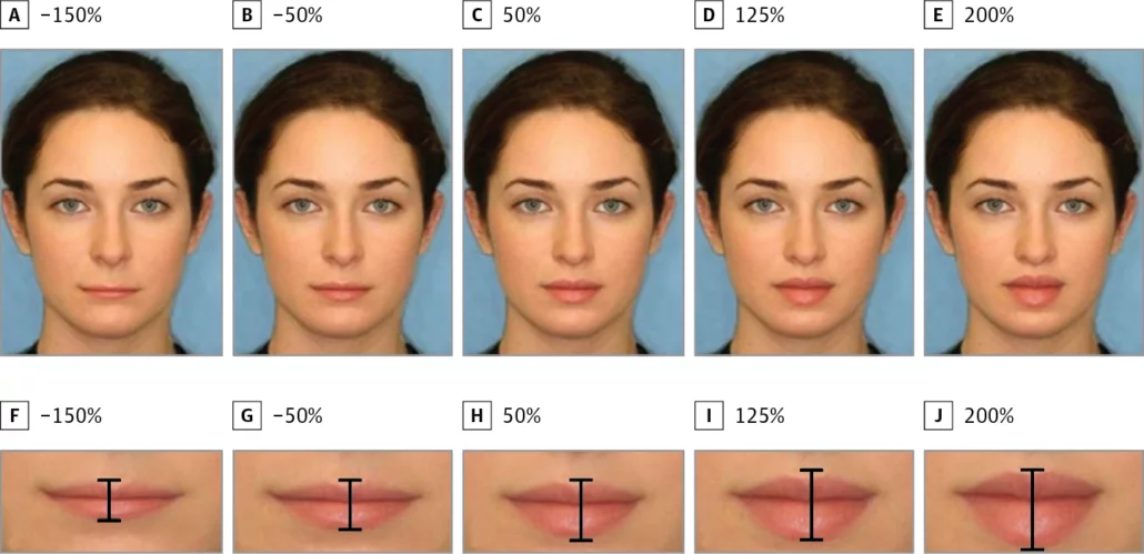 Lip Filler, avoiding duck lips | Elite Medical & Aesthetics | Lone Tree ...