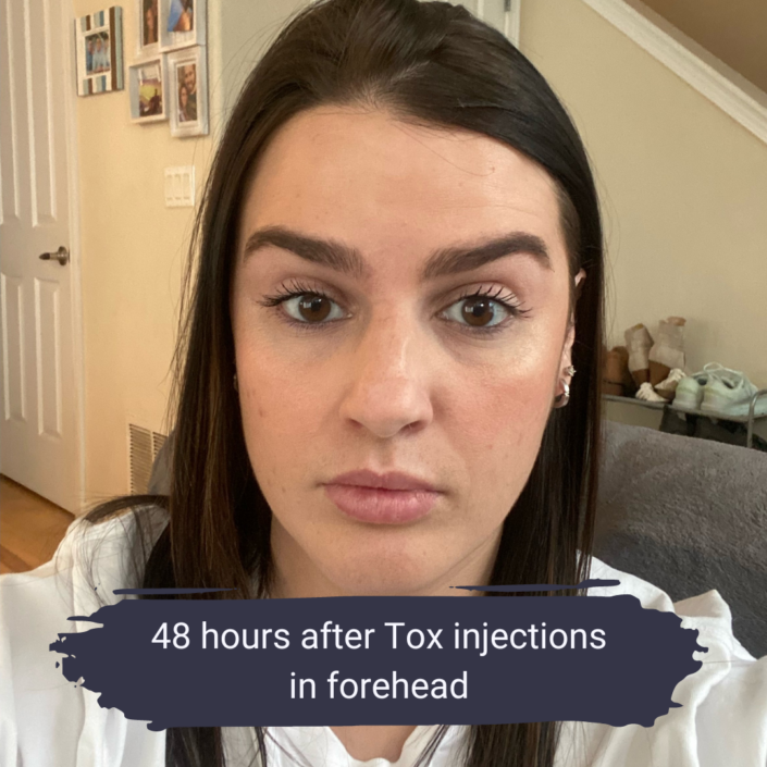 How Botox Kicks In | Elite Medical & Aesthetics | Lone Tree, CO 80124