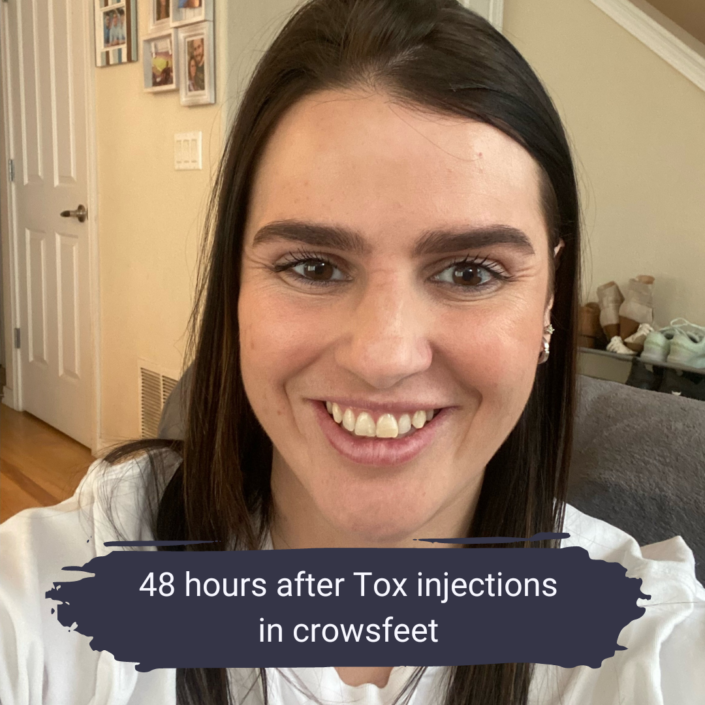 How Botox Kicks In | Elite Medical & Aesthetics | Lone Tree, CO 80124