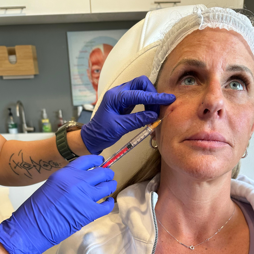 EZ Gel 101 | Elite Medical & Aesthetics | Lone Tree, CO 80124